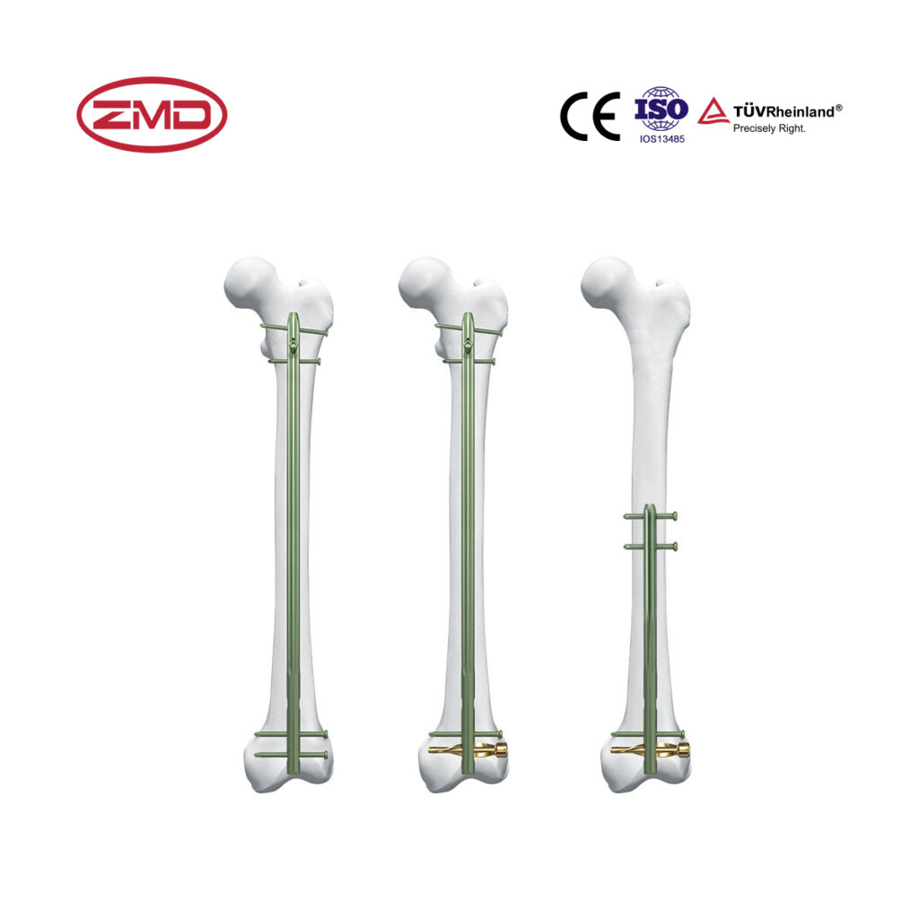 Trauma Internal Fixation System - Pharmaceutical Company